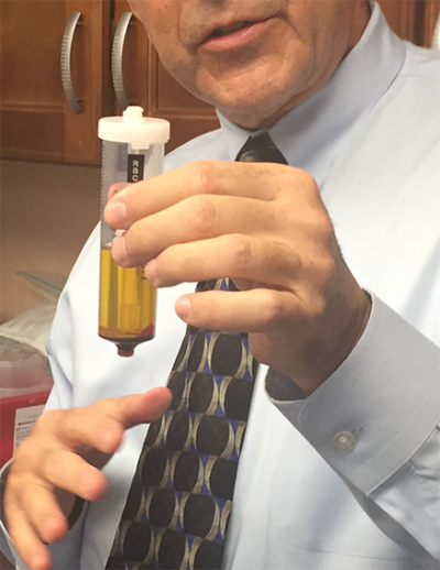 progenprp-seperation - ProGen PRP - Platelet-Rich Plasma Concentration ...