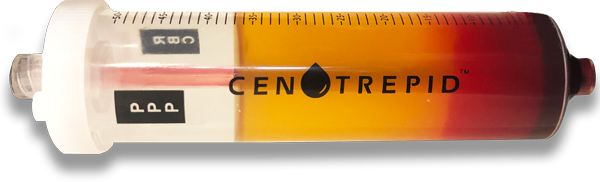Centrepid-600px - ProGen PRP - Platelet-Rich Plasma Concentration System