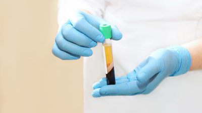 Media - ProGen PRP - Platelet-Rich Plasma Concentration System